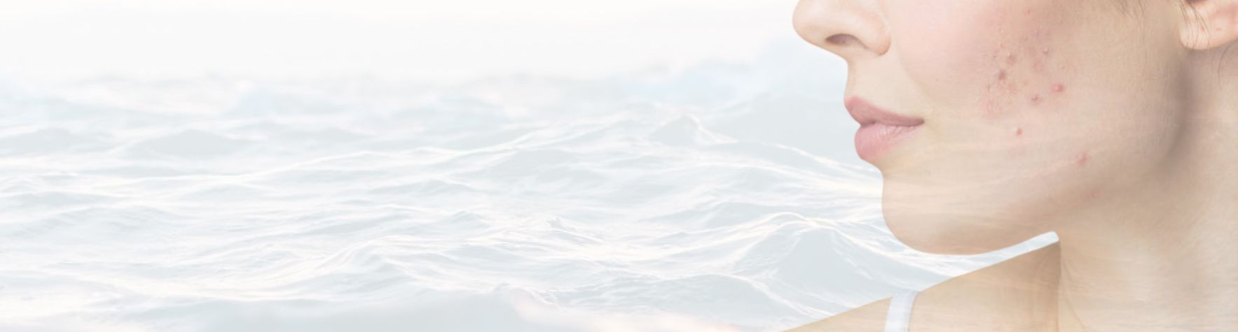 ¿Por qué se me pone la piel roja? Causas y soluciones | Ydroa